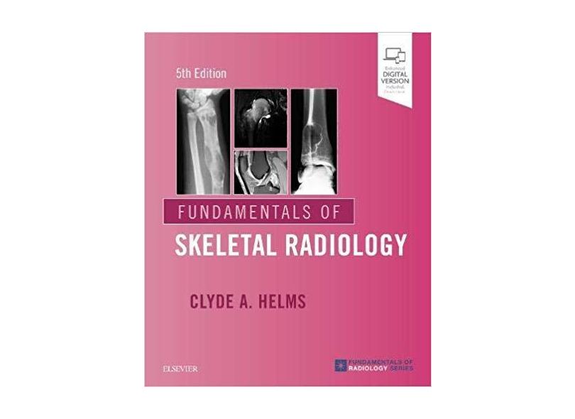 Fundamentals of Skeletal Radiology, 5e - Clyde A. Helms Md ...