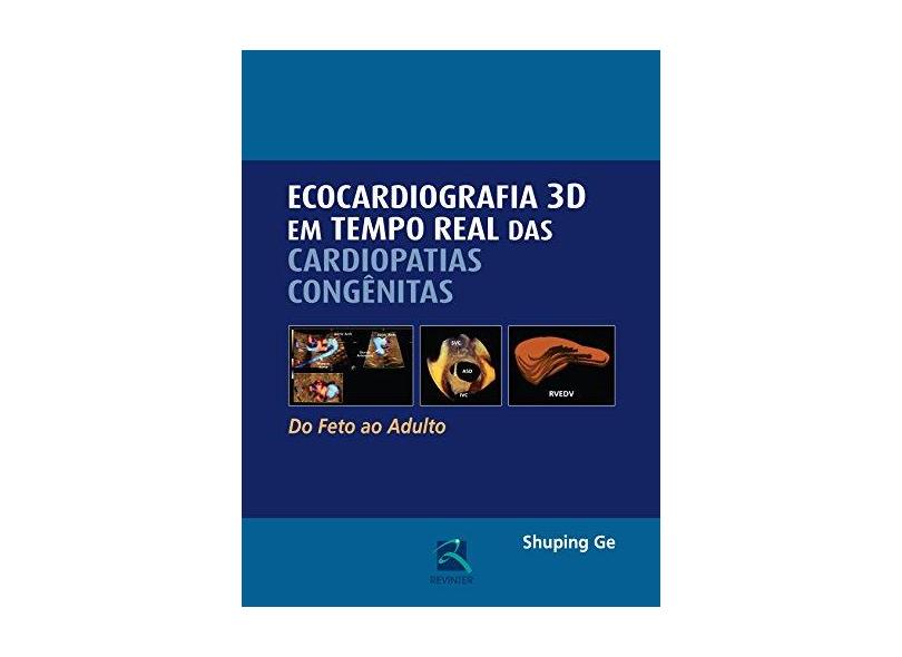 Ecocardiografia 3D Em Tempo Real Das Cardiopatias Congênitas - Shuping ...