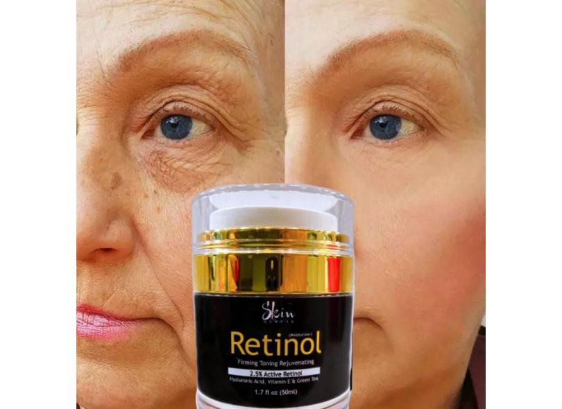 Retinol 2,5% Skin Health Creme Lifting Facial Anti Idade 50ml com o ...
