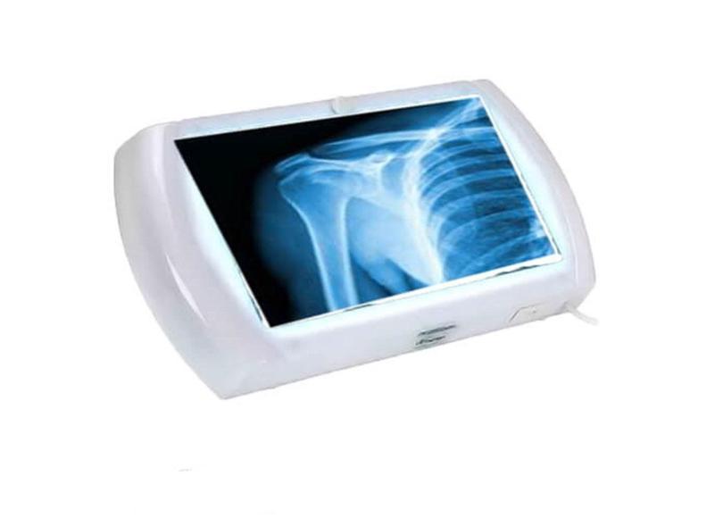 Negatoscópio Slim Panorâmico - Negato Slim (19x35,5x5cm) - Biotron com ...